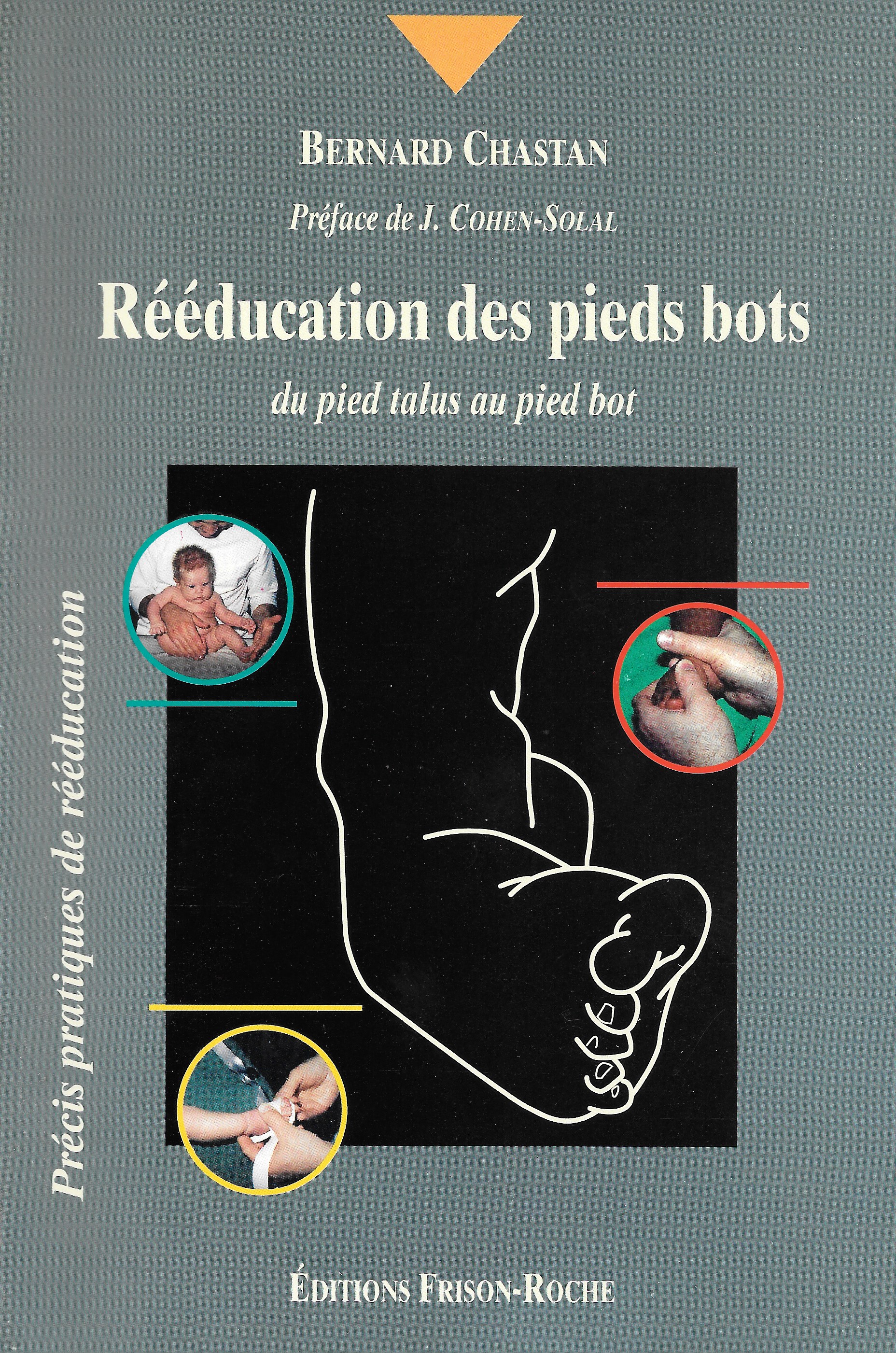 Rééducation des pieds bots - Du pied talus au pied bot - B Chastan ...